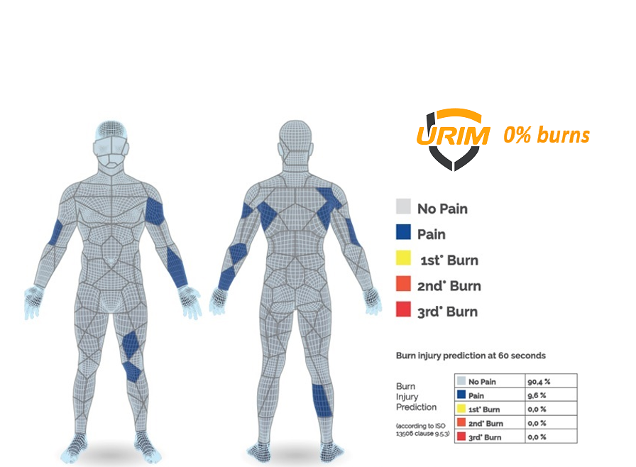 burns - Tekstina Tech